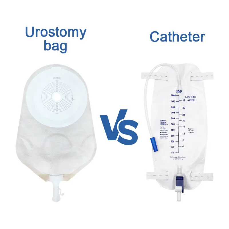 Urostomy Bag Vs Catheter：What’S The Difference - Zodelo Ostomy
